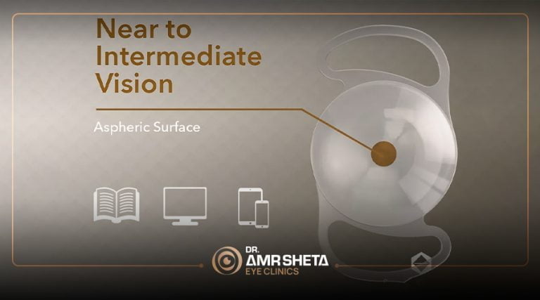 Implantation Of EDOF Lenses For Cataracts – Dr. Amr Sheta